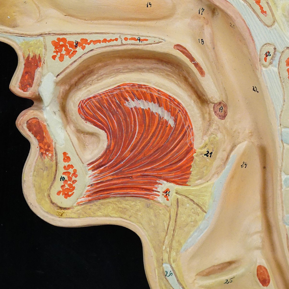 Proantic: Antique Teaching Aid - Midline Incision Of The Human Head By